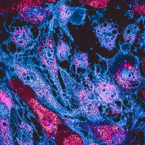 How Big is a Micron?